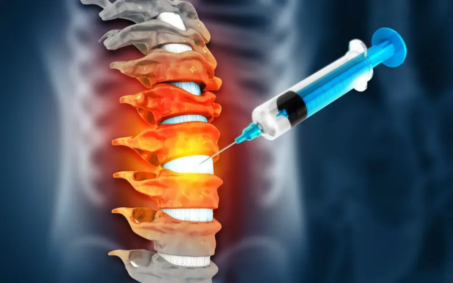 Epidural Injections at Crystal Radiology | Injection Services